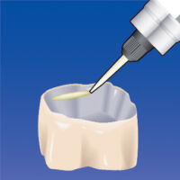 Premier Dental - NexTemp®