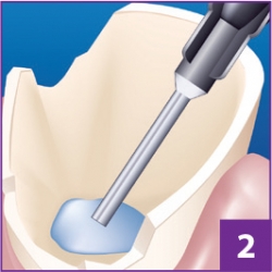 CompCore™ AF Dual-Cure Core Build-up Material