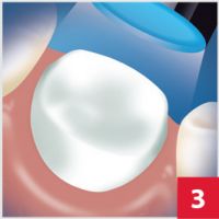 CompCore™ AF Dual-Cure Core Build-up Material