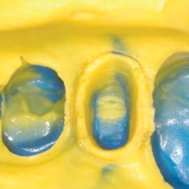 Premier Dental - Traxodent®